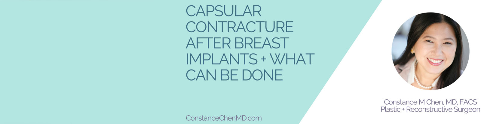 Capsular Contracture After Breast Implants Constance M Chen M D